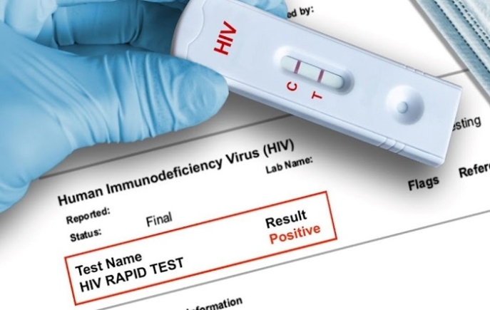 How to Identify Fake HIV Test Kits Flooding Ghana's Market | Opemsuo 104.7